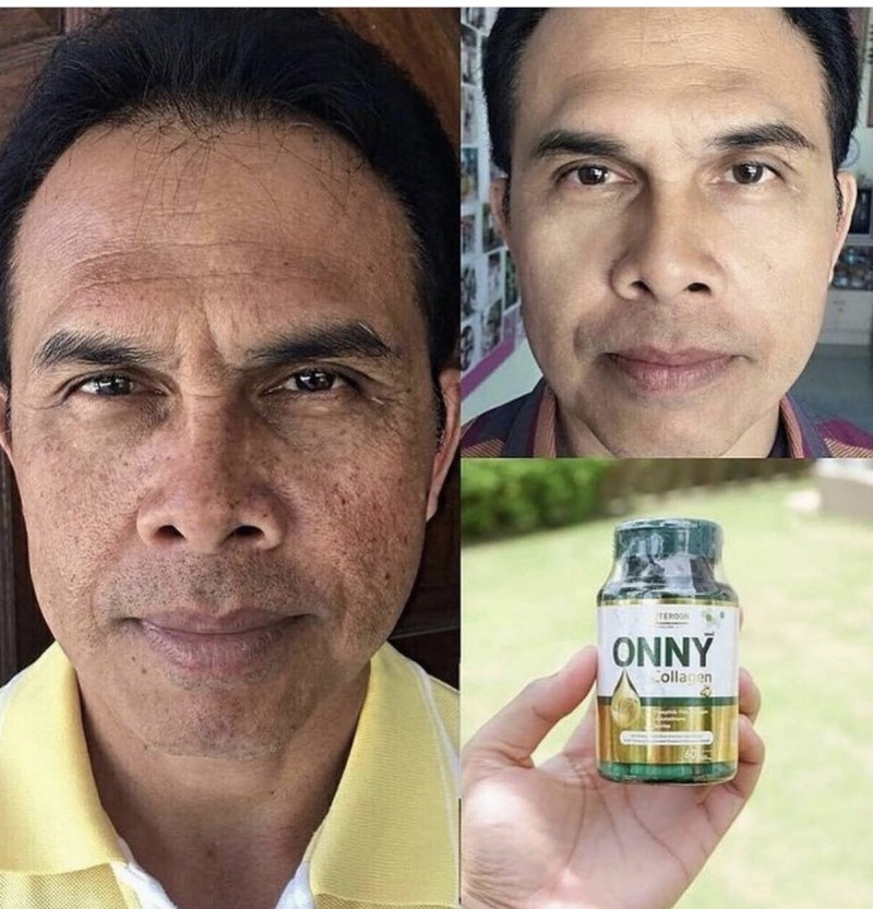 Buy Onny collagen by Royalsglow on Selar