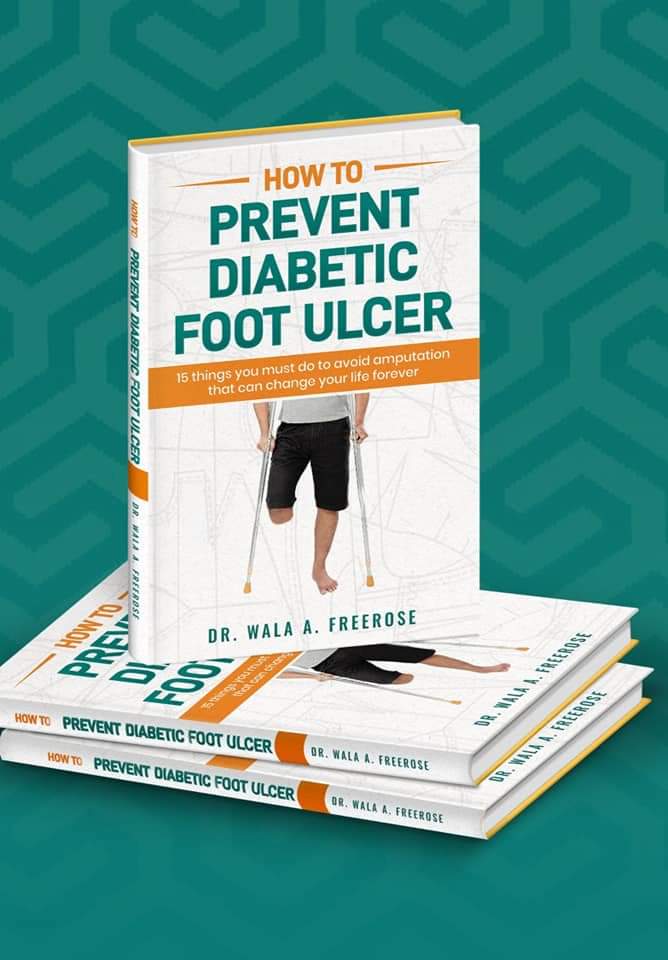 Buy HOW TO PREVENT DIABETIC FOOT ULCERS: 15 THINGS YOU MUST DO TO ...