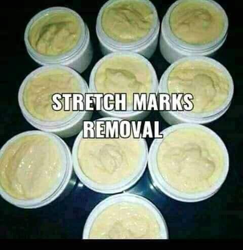 Buy Fast Stretch Mark Removal set by Obilor Oluebube Jennifer on Selar