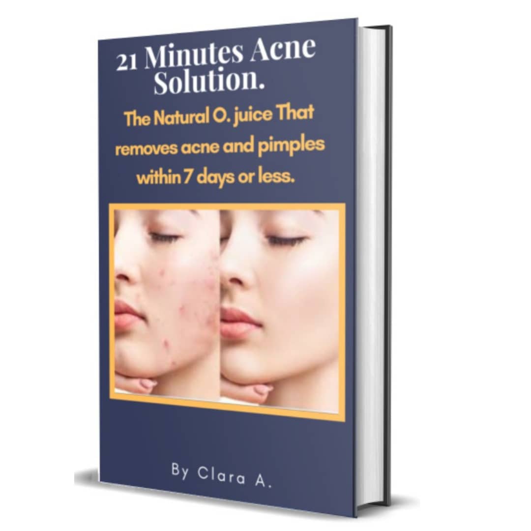 Buy 21 Minutes Acne solution by Okafor Christian on Selar