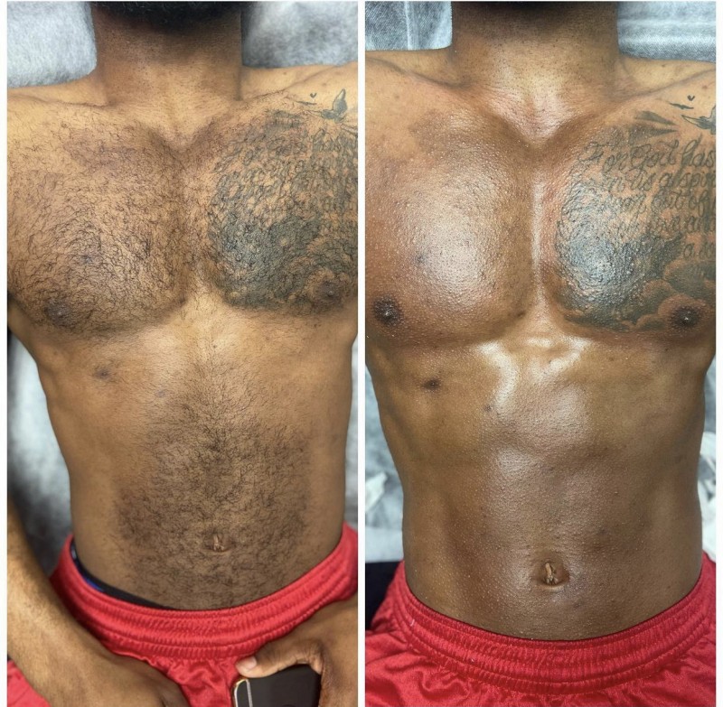 Buy Chest wax (male) by Massageenvy aesthetics on Selar