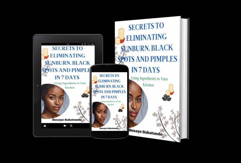 Buy SECRETS TO ELIMINATING SUNBURN, BLACK SPOTS AND PIMPLES IN 7 DAYS USING INGREDIENTS IN YOUR ...