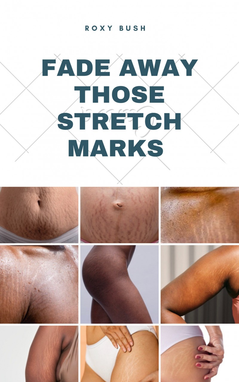 Buy FADE AWAY THOSE STRETCH MARKS by Katioress on Selar