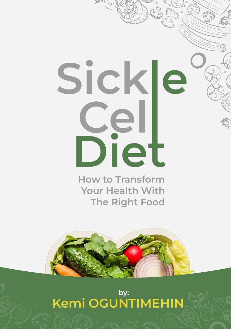 Buy SICKLE CELL DIET: How to transform your health with the right food ...