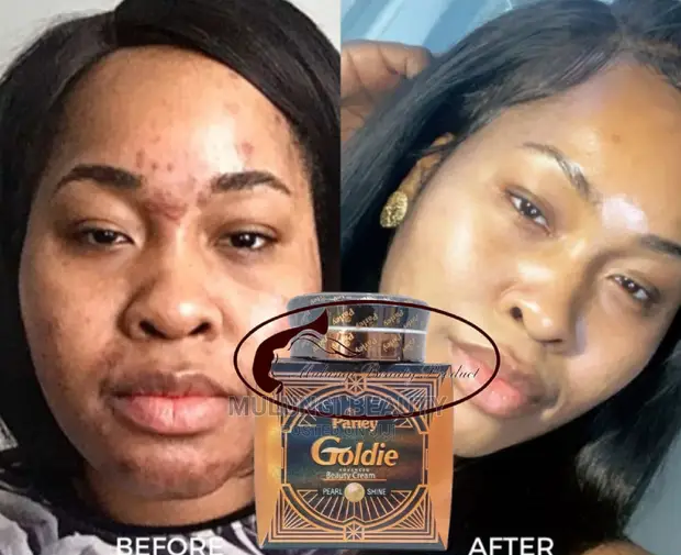 Buy Parley Goldie Face Cream(original) by NAFS BEAUTY SUPPLIES on Selar