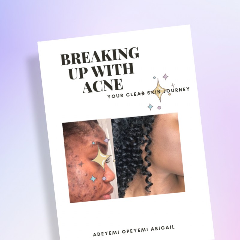 Get Breaking up with ACNE; your clear skin journey. by Abigail Adeyemi ...