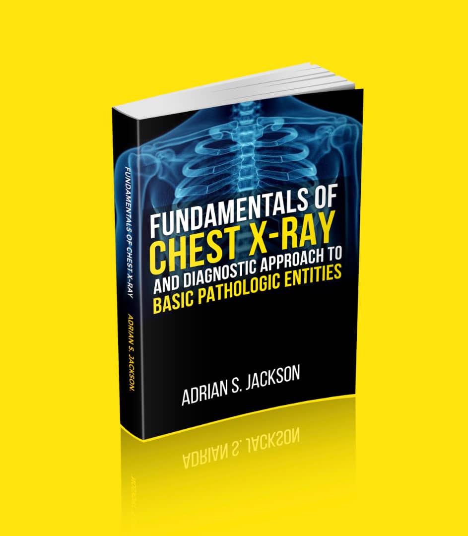 Buy FUNDAMENTALS OF CHEST X- RAY AND DIAGNOSTIC APPROACH TO BASIC PATHOLOGIC ENTITIES by JAs ...