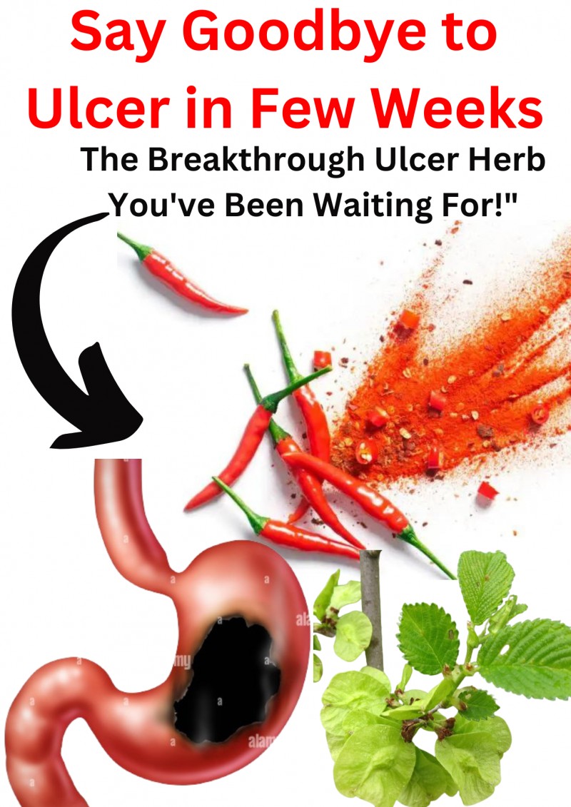Buy Ulcer Cure by Ndomadu Ifeanyi Kenneth on Selar