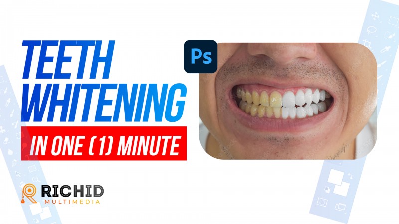 Buy Teeth Whitening Action by Richid Multimedia on Selar