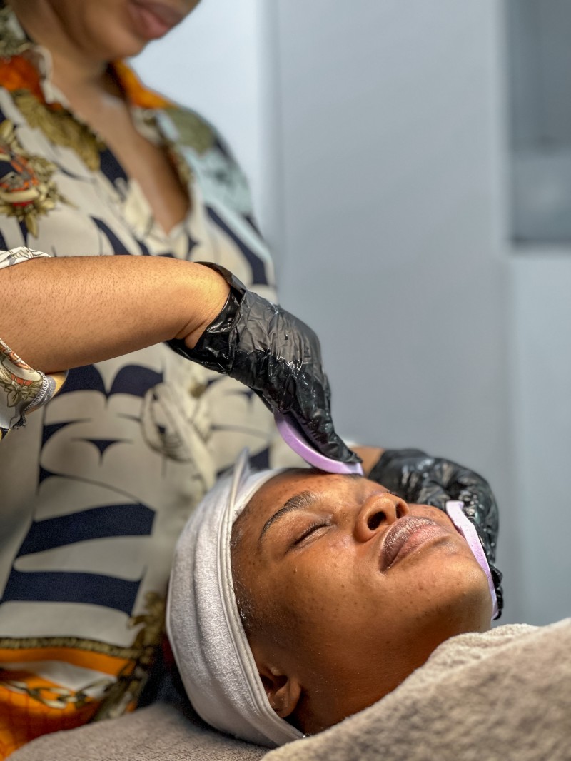 Buy Microneedling with Anti-aging Facial by Sigma Med Spa by Luglow on ...