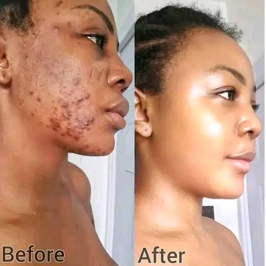 Buy Spotless facial Cream by Obilor Oluebube Jennifer on Selar