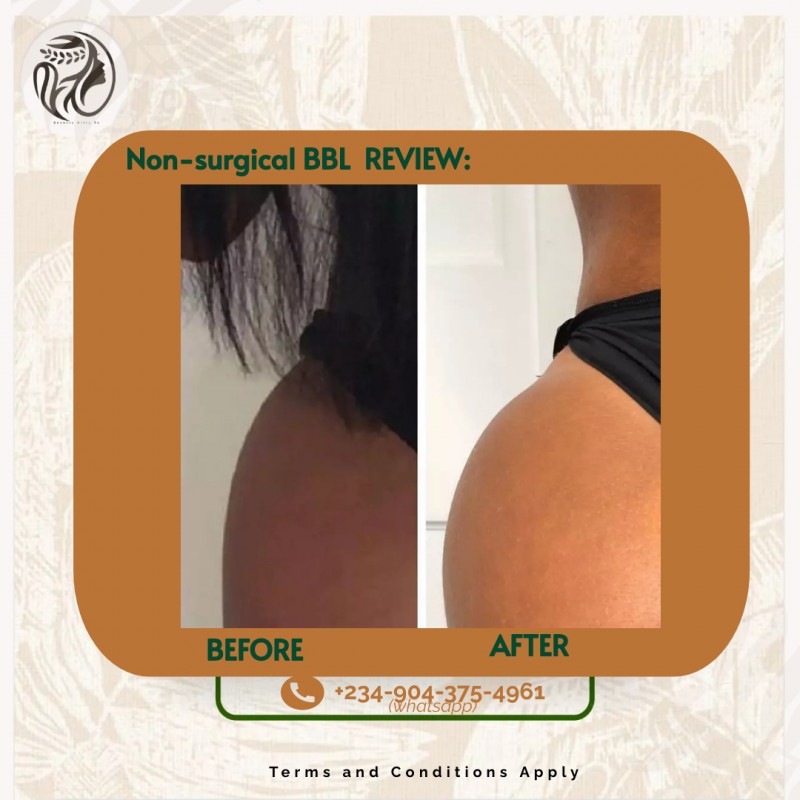 Buy Nonsurgical BBL discount (Model) by Credeno on Selar