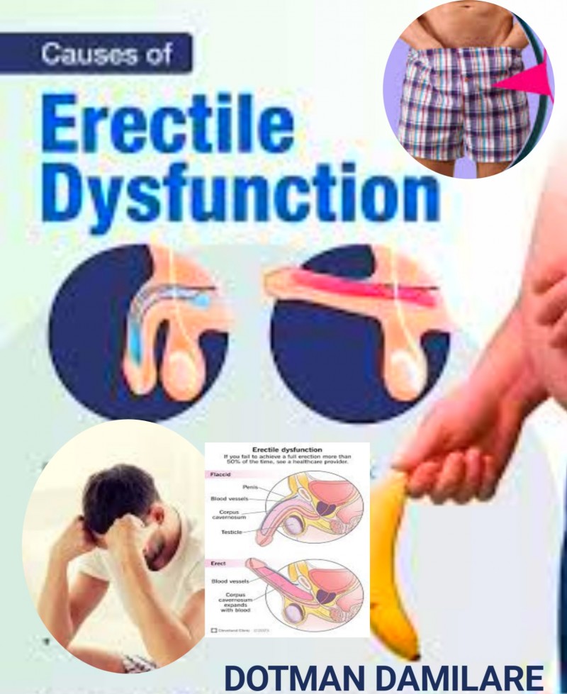 Buy ERECTILE DYSFUNCTION by Dotman on Selar
