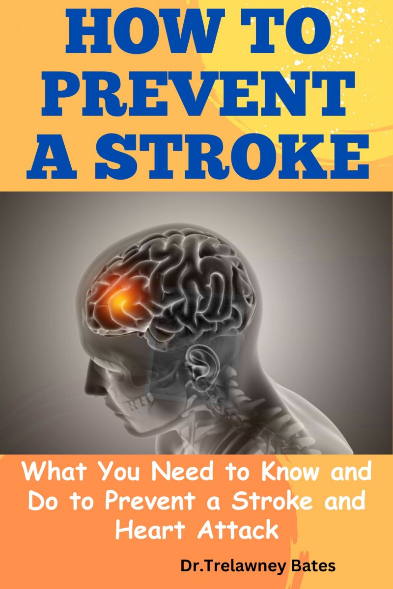 Buy HOW TO PREVENT A STROKE What You Need to Know and Do to Prevent a ...