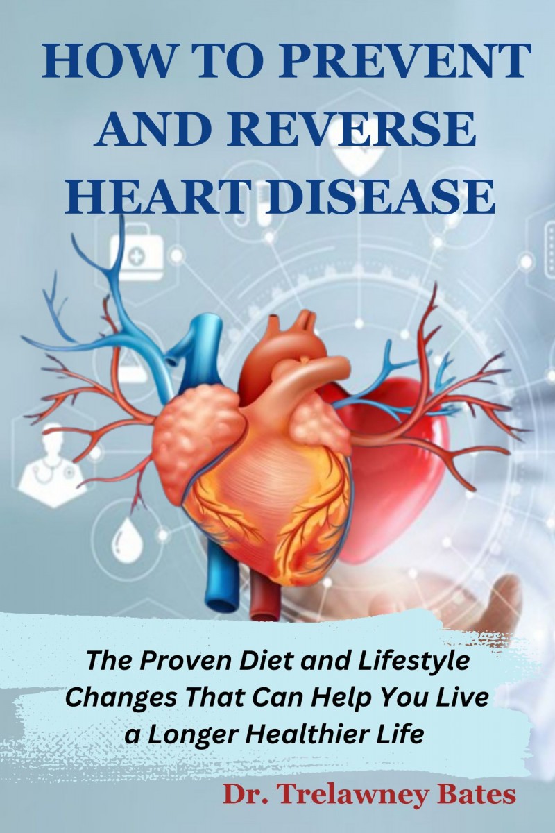 Buy How To Prevent And Reverse Heart Disease The Proven Diet And