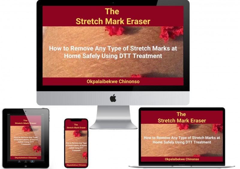 Buy The Stretch Mark Eraser Treatment Program by Okpalaibekwe Chinonso ...